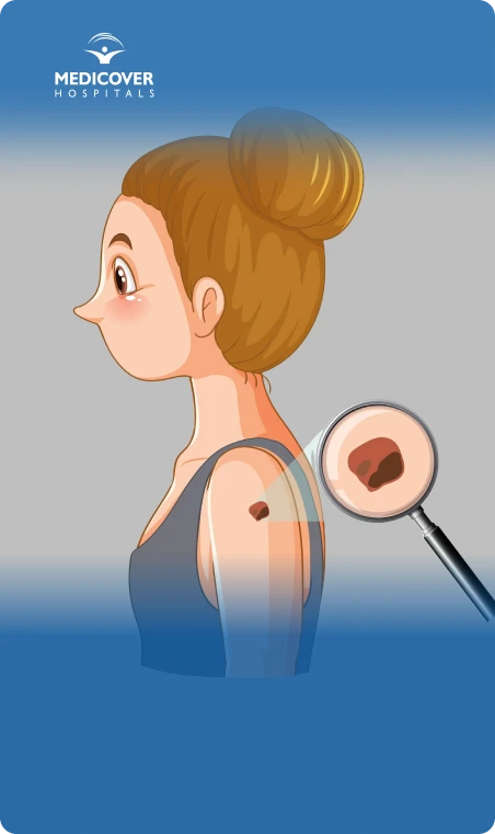 Tissue Turning Black or Dying Causes and Treatment